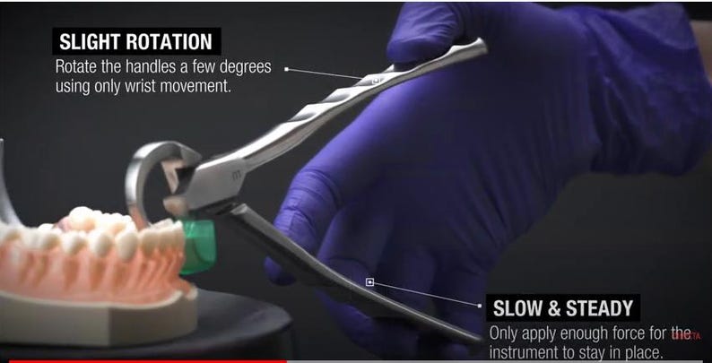 Dental Extraction Forceps Molar Series Set of 4 Pcs Dental Forceps ...