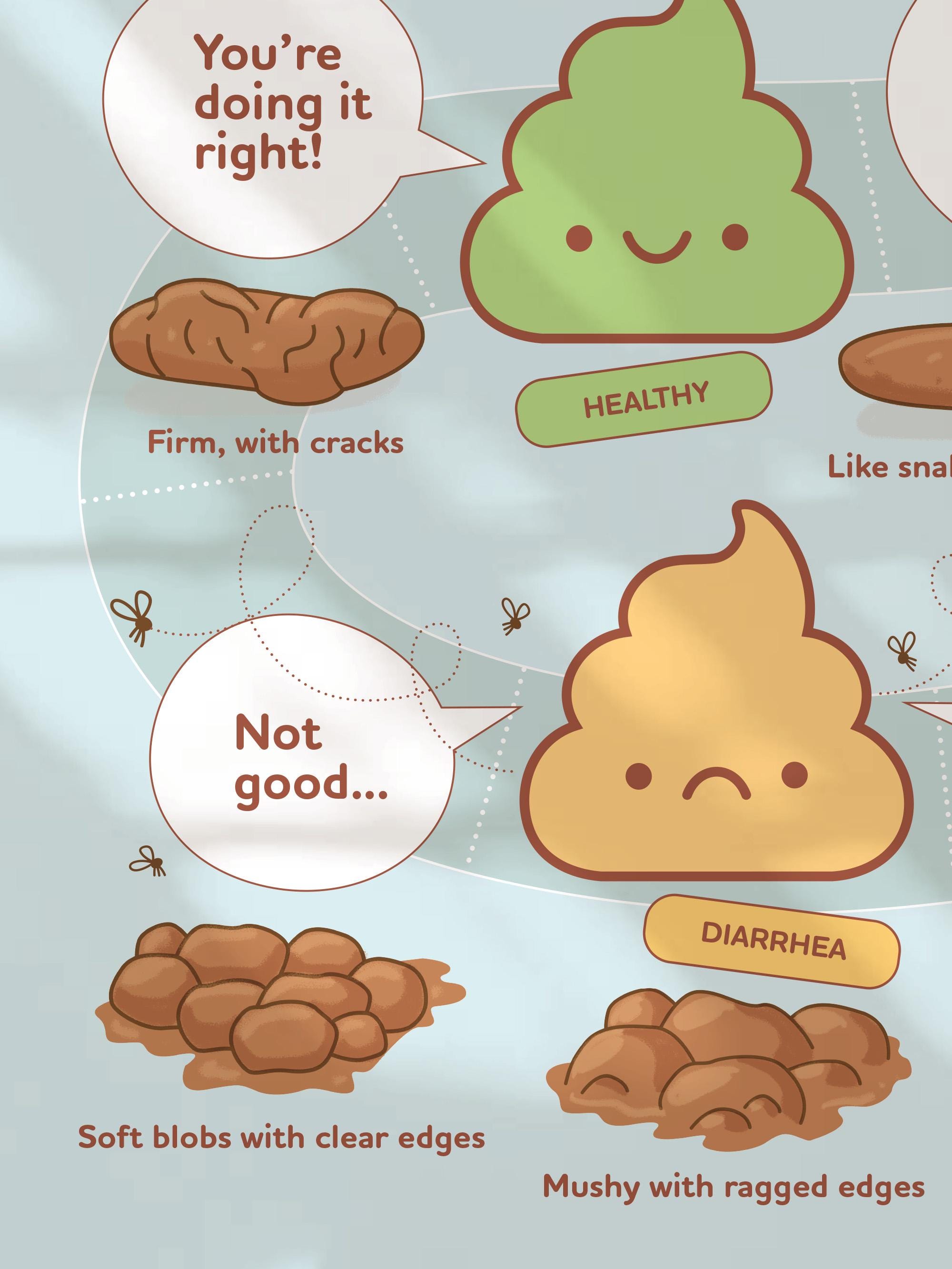 Bristol Stool Scale Poster, Medical Human Anatomy Wall Art, Funny Poop ...