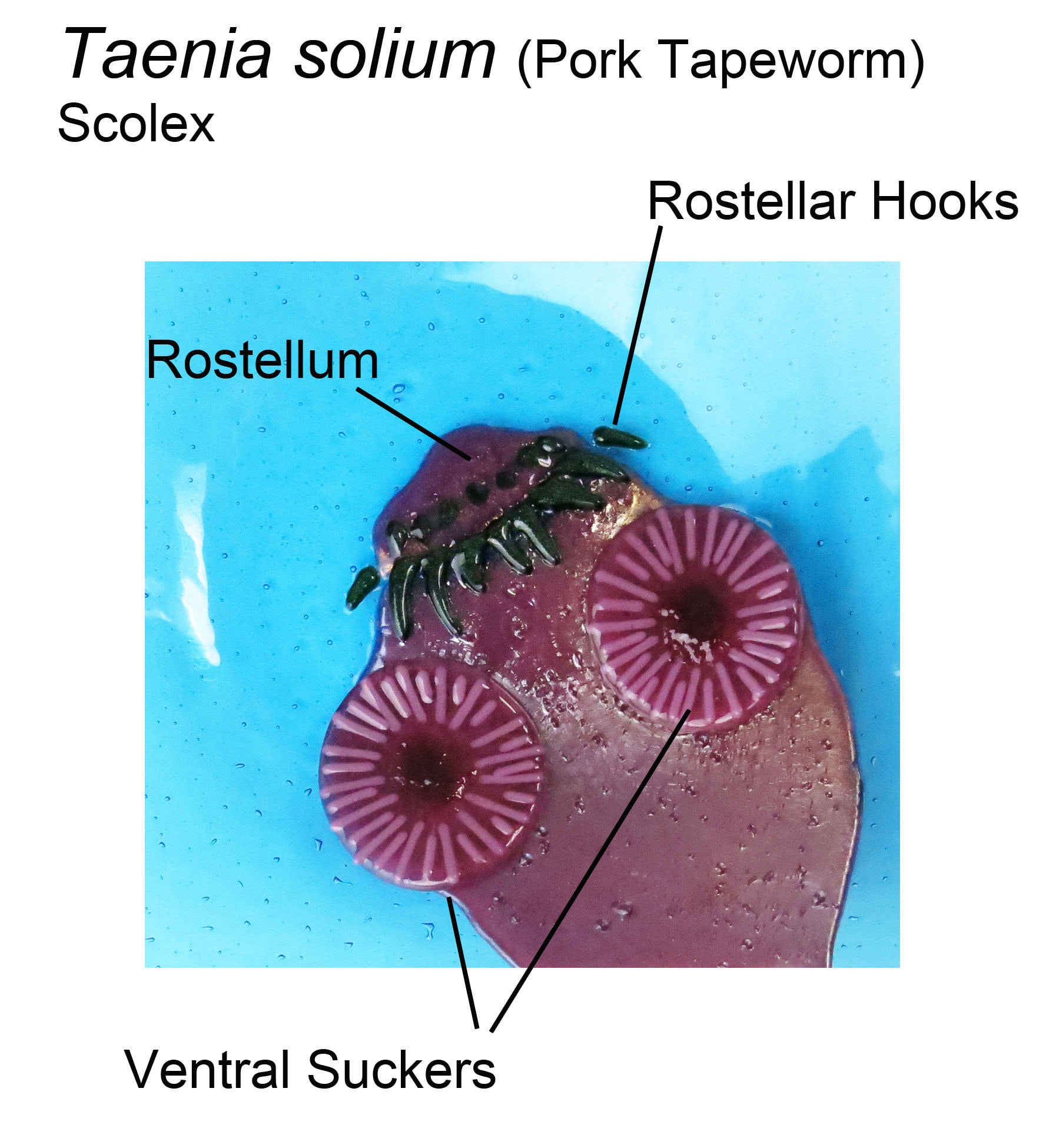Tapeworm Scolex Diagram