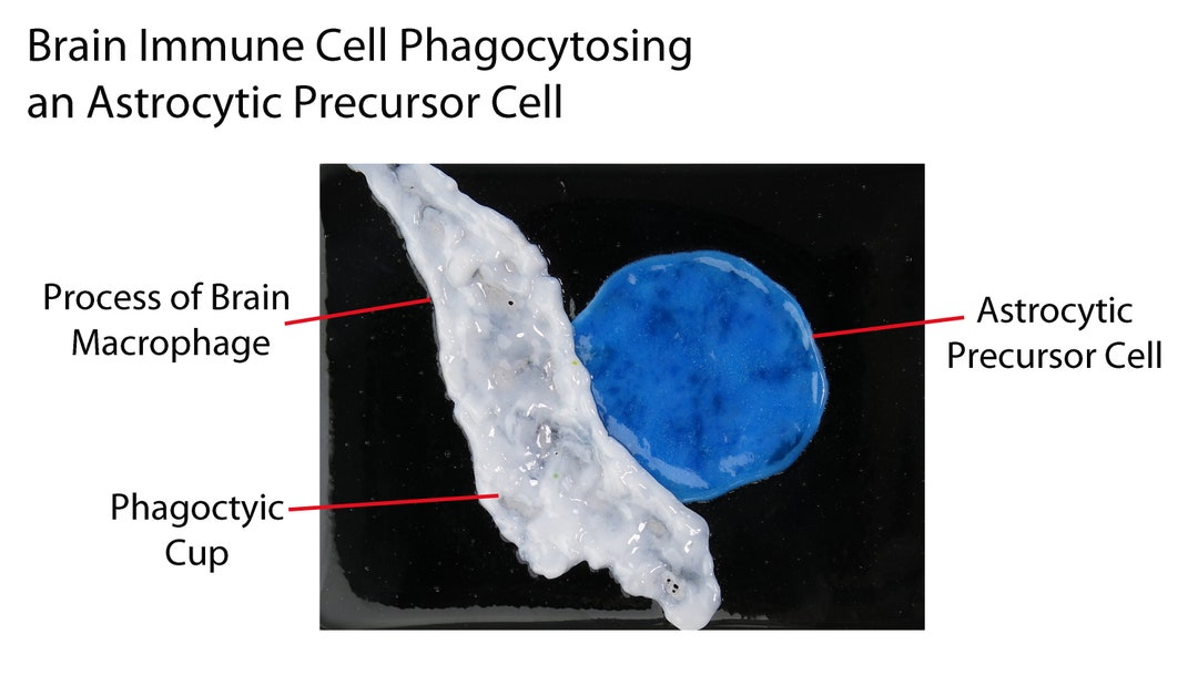 Brain Macrophage Phagocytosing a Precursor Cell - Etsy