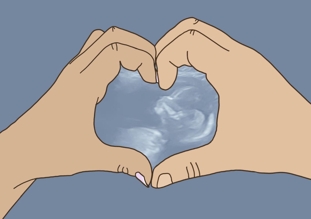 Baby Scan Photo, Digital Image, Digital Baby Scan, Personalised Art ...