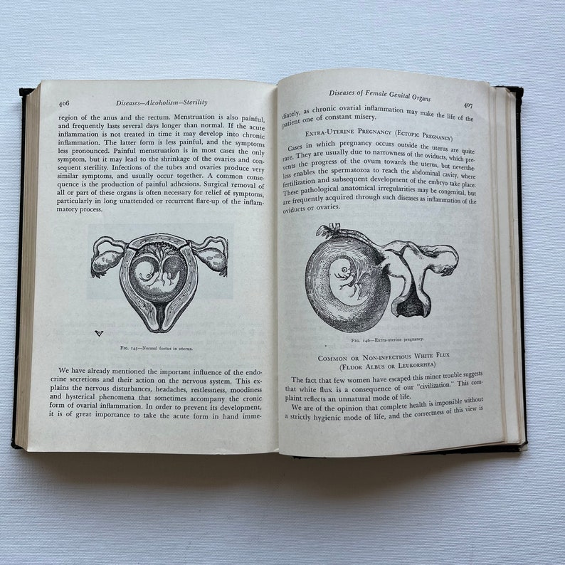 Encyclopedia Of Sex Illustrated Antique Book Sexual Organs Etsy