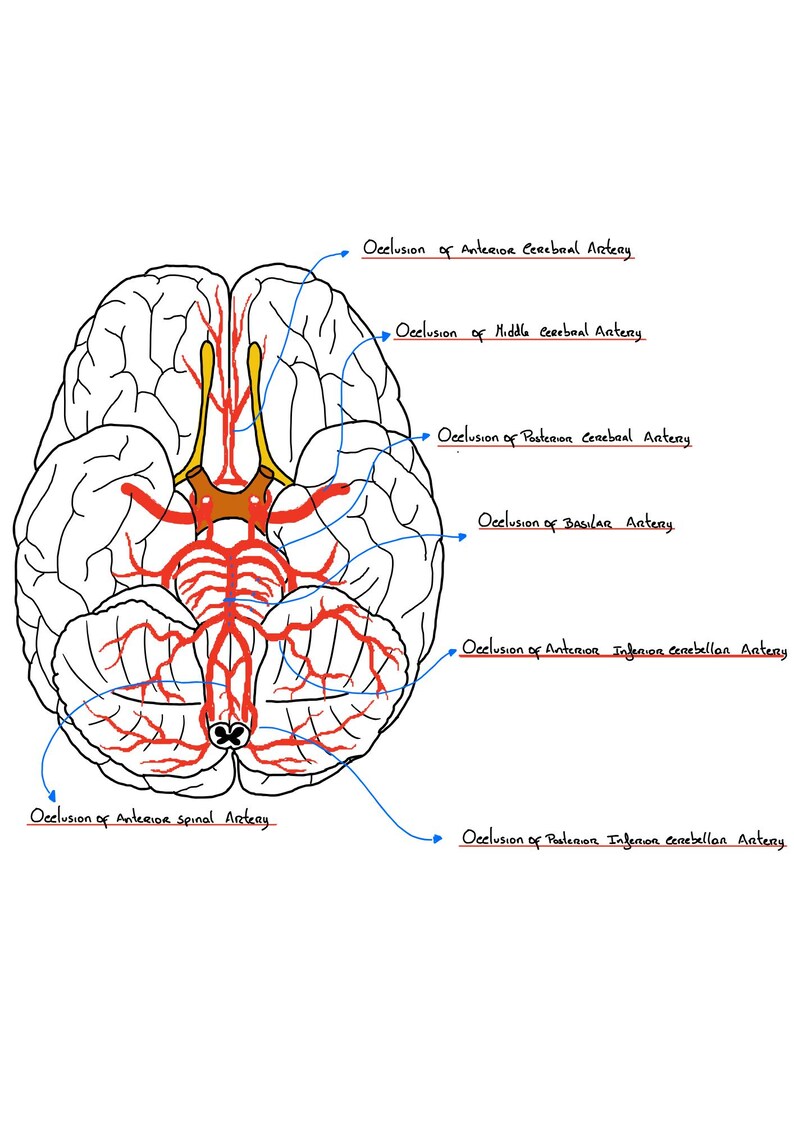 Brain Vascular Anatomy - Neuro Anatomy, Anatomy Handwritten Sketches ...