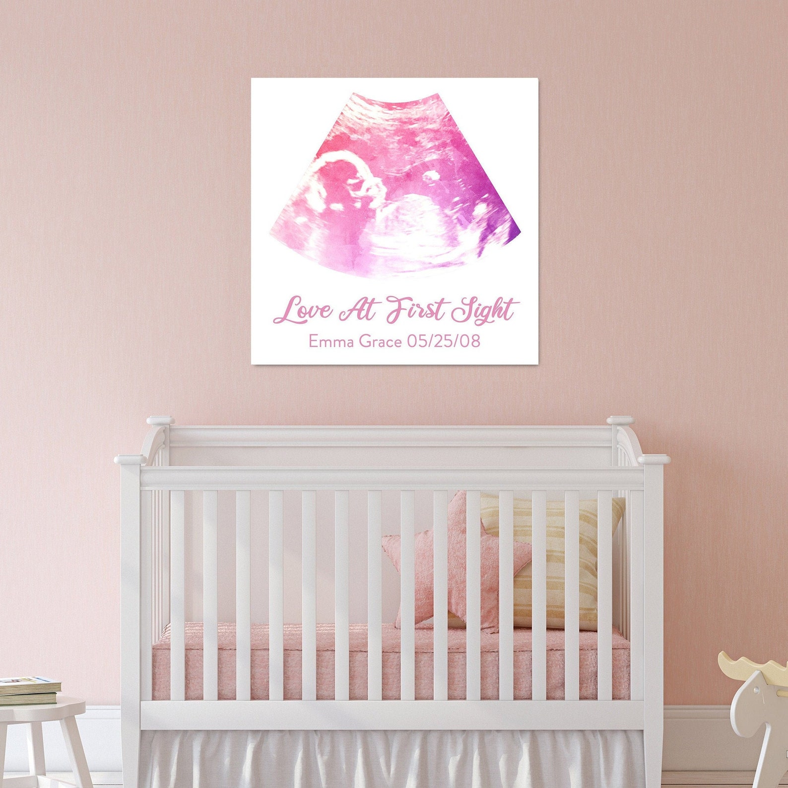 Sonogram Art Ultrasound Print Watercolor Nursery Decor | Etsy