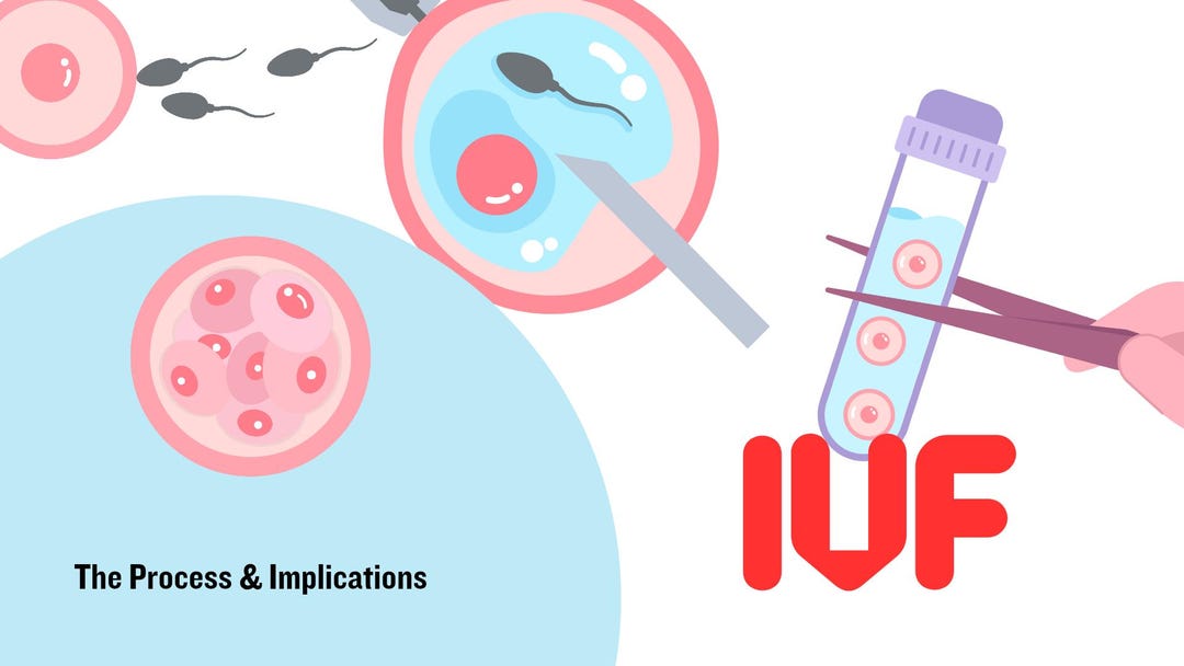 IVF PROCESSES GUIDE - Etsy