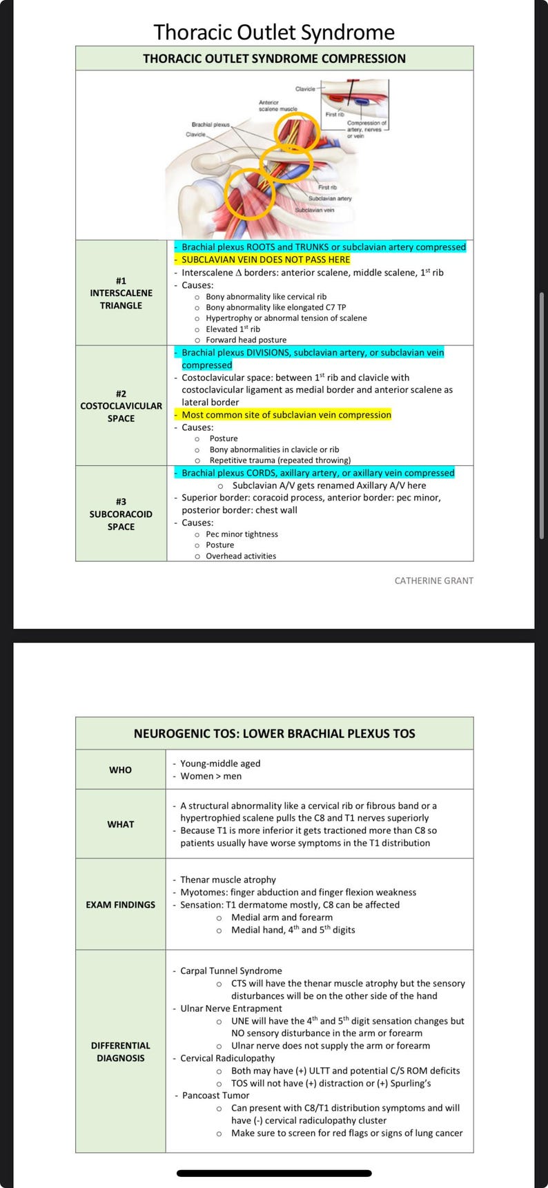 OCS - Thoracic Outlet Syndrome Study Guide - Etsy