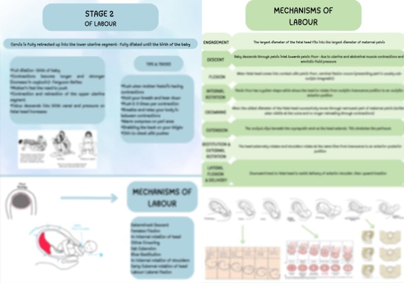 Stages of Labour Poster - Etsy
