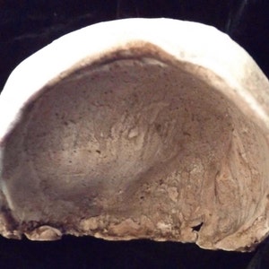 Human Half Skull Deformed Decayed Statue Gothic Open Back Skeleton Bone ...