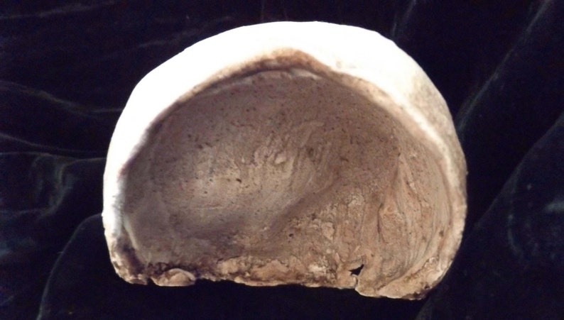 Human Half Skull Deformed Decayed Statue Gothic Open Back - Etsy