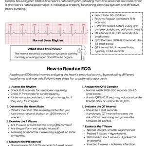 EKG Study Guide - Comprehensive Companion for NHA Exam & Allied Health ...
