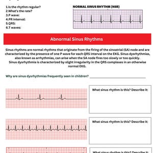 EKG Guided Notes | NHA CET Study Companion | Printable Study Guide - Etsy
