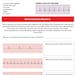 EKG Guided Notes | NHA CET Study Companion | Printable Study Guide - Etsy