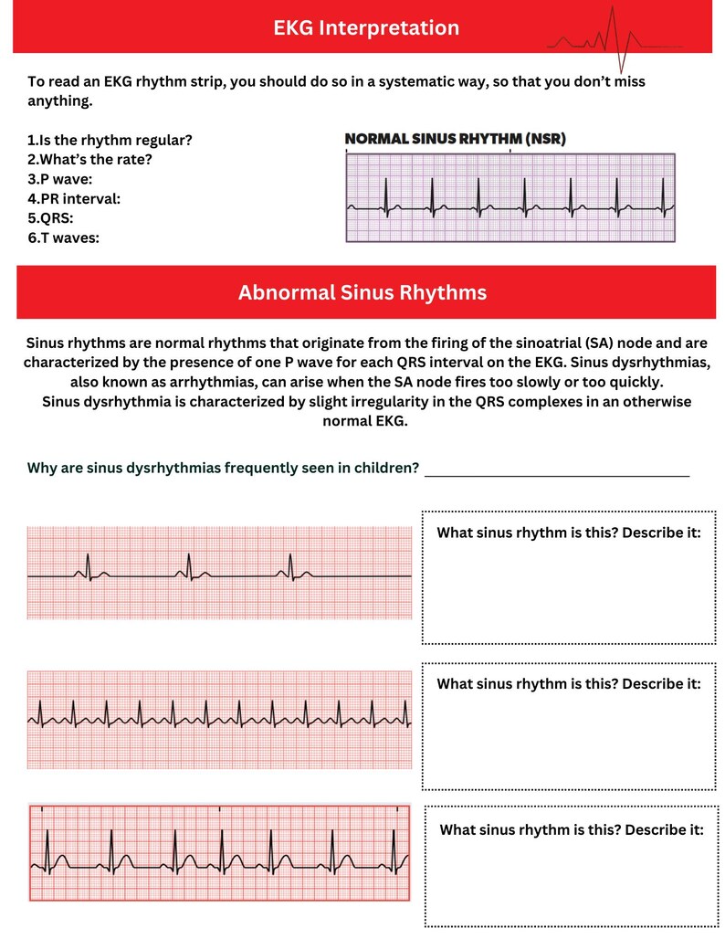 EKG Guided Notes | NHA CET Study Companion | Printable Study Guide - Etsy