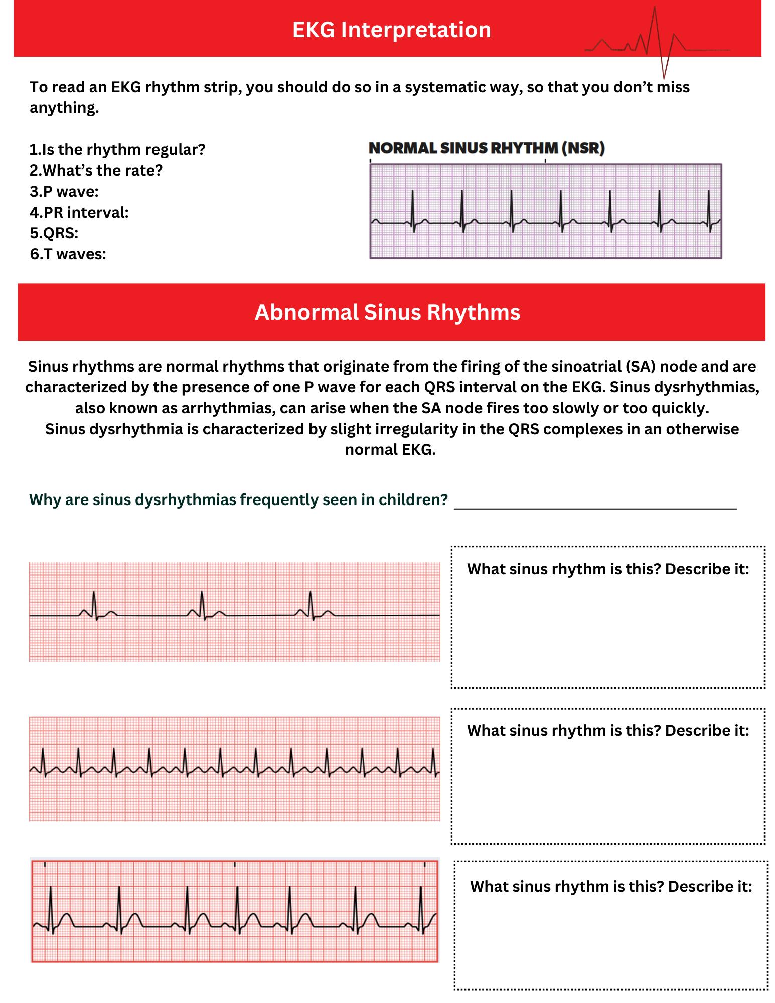 EKG Guided Notes | NHA CET Study Companion | Printable Study Guide - Etsy