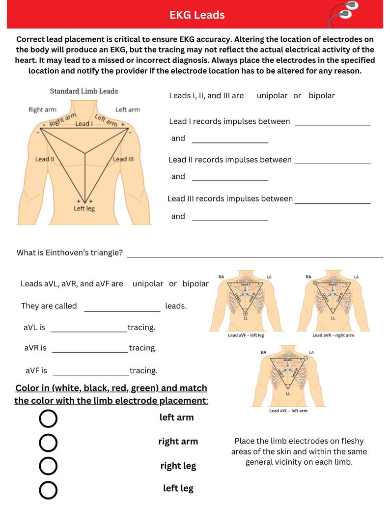 EKG Guided Notes | NHA CET Study Companion | Printable Study Guide - Etsy