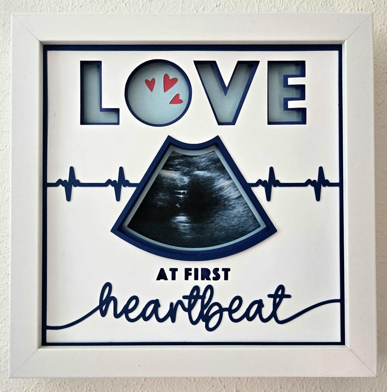 Love at First Heartbeat 3D Framed Shadow Box - Baby's Ultrasound ...