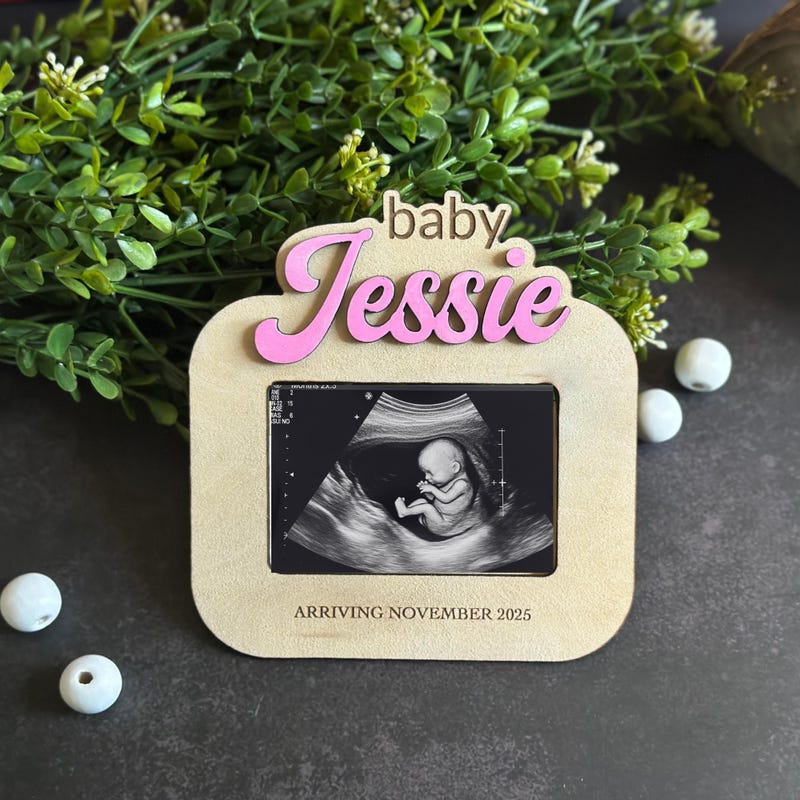 Ultrasounds Magnet - Etsy