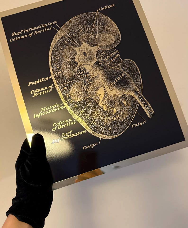 3 Kidney Art Poster Gold Anatomy Art Anatomical Kidney Nephrology Art ...