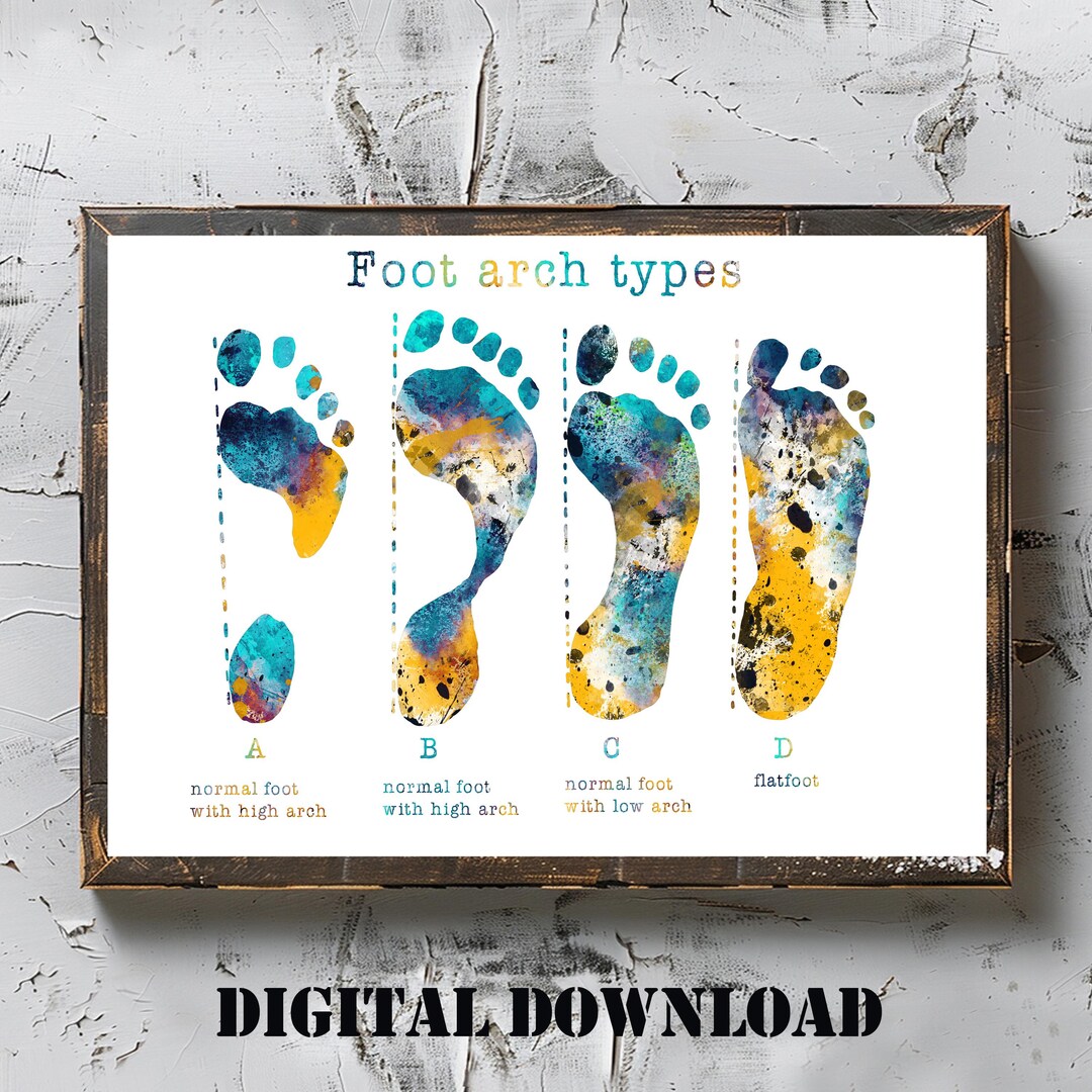 Types of Footprints Printable Wall Art Foot Arch Types Watercolor Print ...