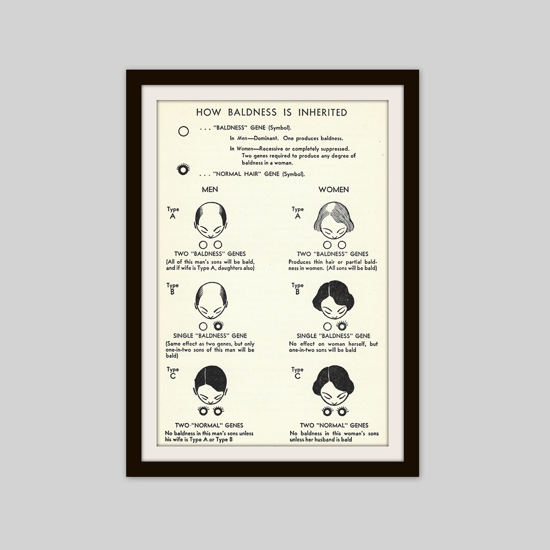 1939 How Baldness is Inherited Illustration, Genetics and Heredity ...