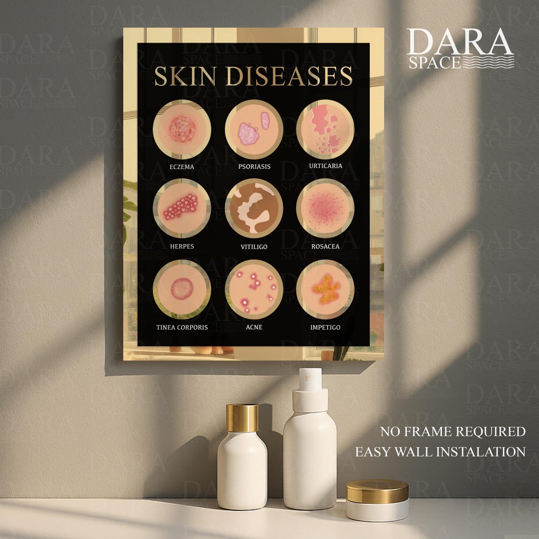 Skin Diseases Diagram – Gold Acrylic Mirror Sign, Cosmetology Wall Art ...
