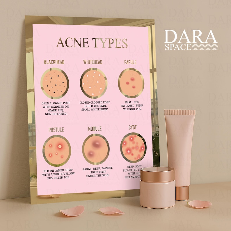 Gold Acrylic Types of Acne Sign – Skincare Clinic Wall Art, Esthetician ...