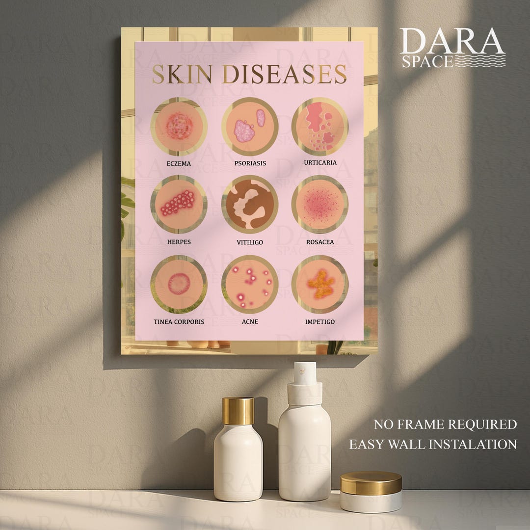 Skin Diseases Chart – Gold Acrylic Mirror Wall Sign, Dermatology and ...