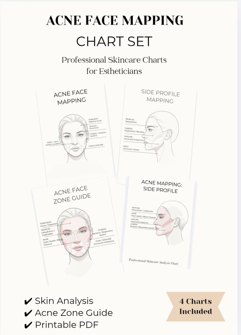 Acne Face Mapping Guide | Digital Download & Skin Analysis Chart for ...