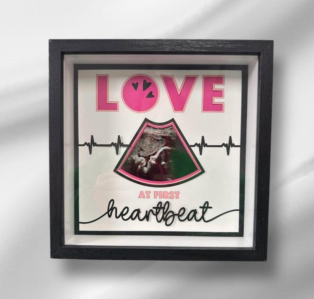 Ultrasound Display Frame - Etsy