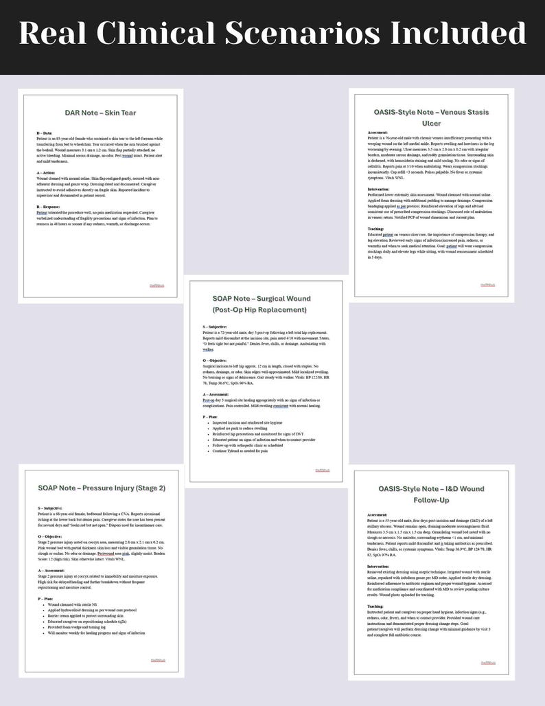 Wound Care Nursing Charting Kit, Soap, Dar, Oasis Notes, Printable and ...
