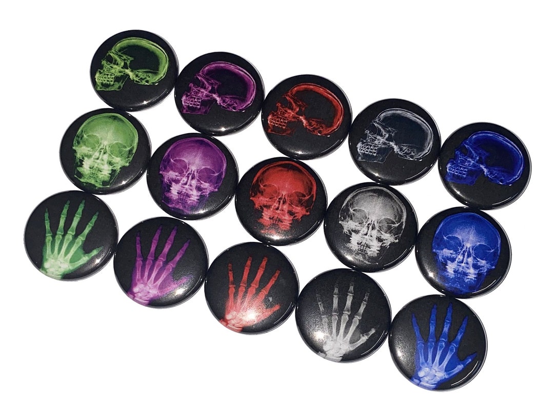 Radiology, 1", 1.25", Button, Xray, Radiology Theme, Bone, Skeleton ...