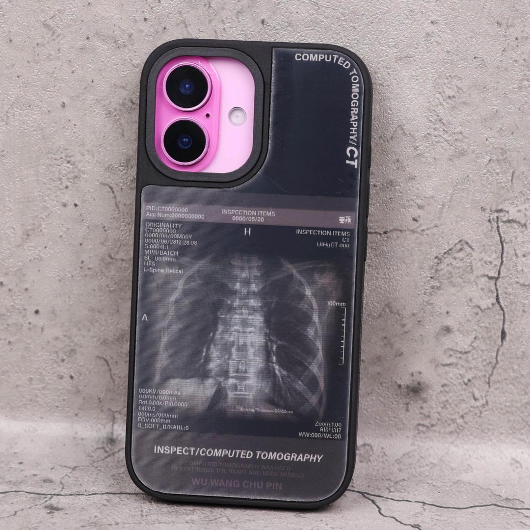 X Ray CT Scan Gradient Grating Magnetic Ring iPhone Case Medical ...