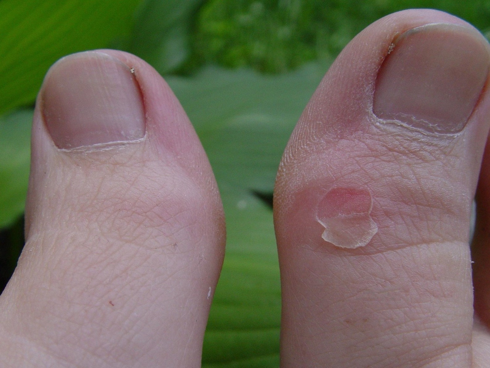 Foot Fetish - Blister Blocker Balm - Foot Friction Fighter - Etsy