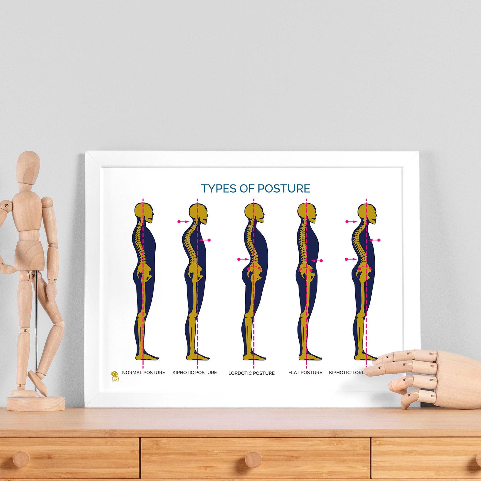 Types of Posture Anatomy Poster A2 Size Digital Download Postural ...