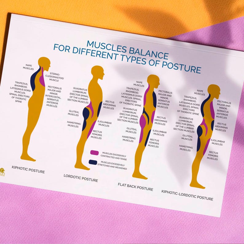 Muscle Balance Posture Types Anatomy Chart (digital Download) - Etsy
