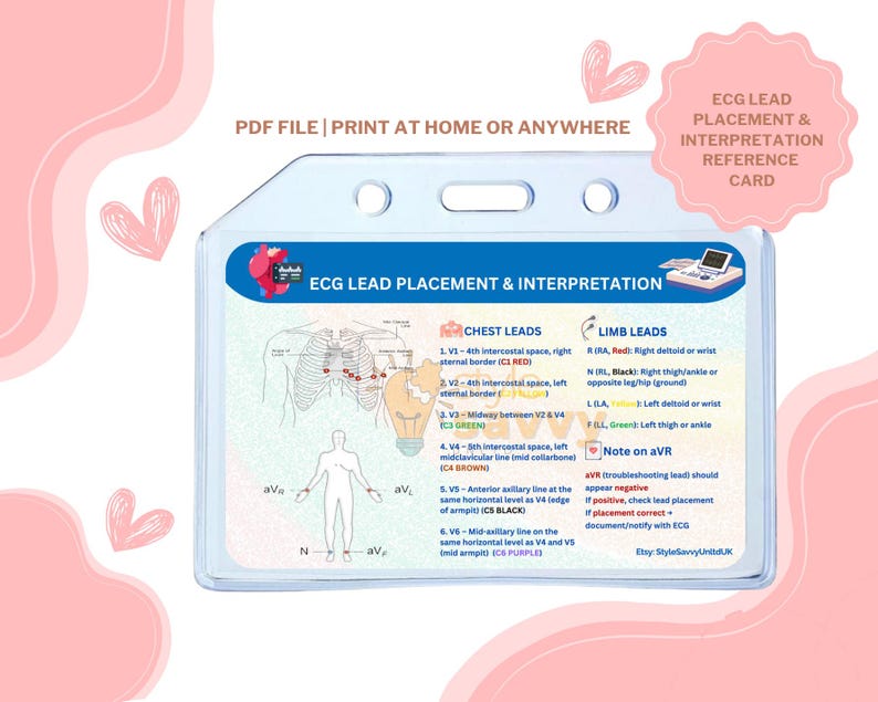 ECG Reference Card: Lead Placement & Interpretation (printable PDF ...