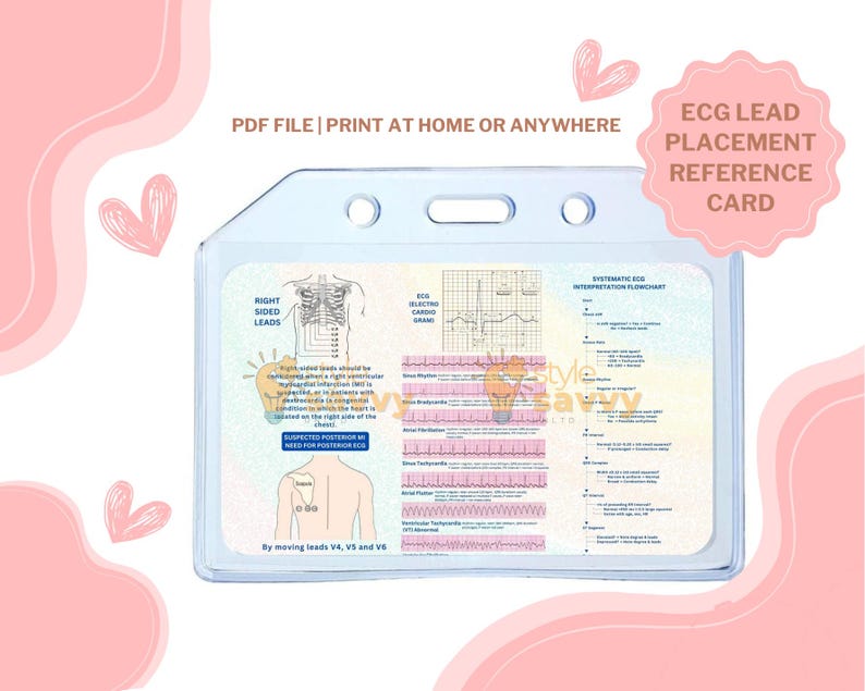 ECG Reference Card: Lead Placement & Interpretation (printable PDF ...