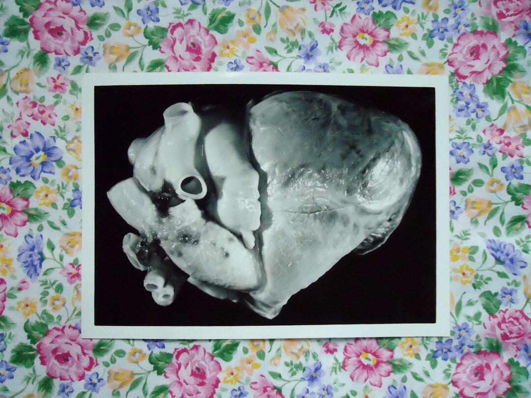 5 Vintage Human Heart Anatomy Photographs 5x7 - Etsy