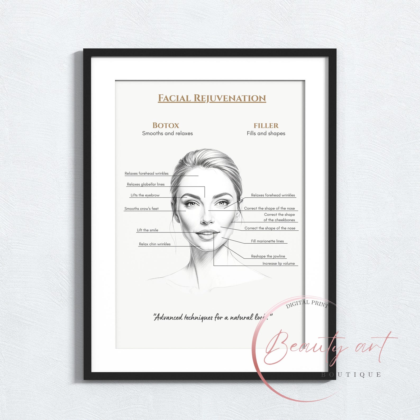 Botox and Filler Poster, Cosmetic Injection Art (digital Download) - Etsy