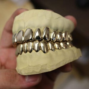 Custom Handmade Grillz: Solid Silver or Gold, Precision Fit - Etsy