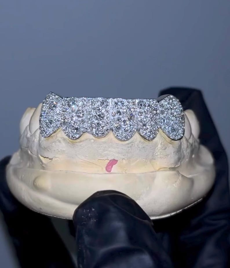 Custom Mosaic Set Lab Diamond Grillz: Sterling Silver, 10K/14K Gold ...