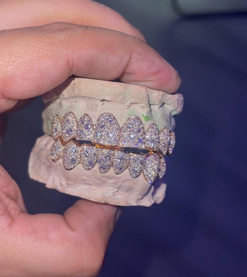 Custom Mosaic Set Lab Diamond Grillz: Sterling Silver, 10K/14K Gold ...