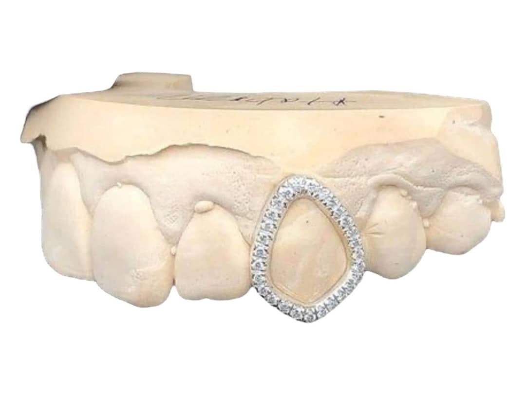 Open Window Iced Out Custom Grillz,silver and Gold With Moissanite ...