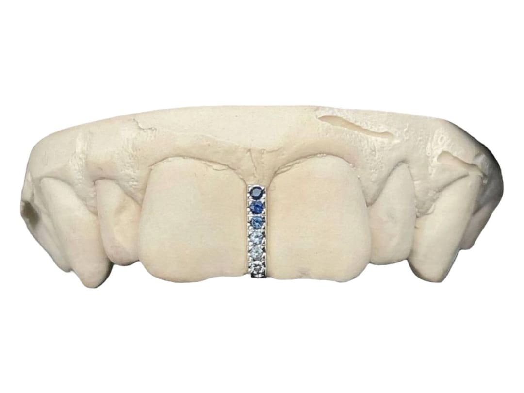 Iced Out Diamond Gap Grillz: Custom Gemstone Tooth Cap - Etsy