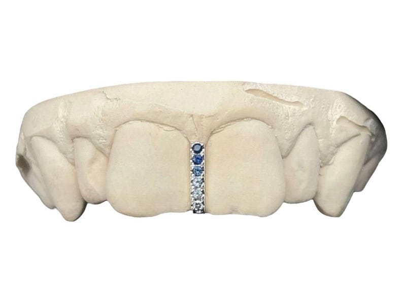 Iced Out Diamond Gap Grillz: Custom Gemstone Tooth Cap - Etsy