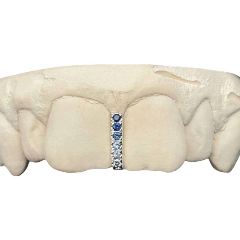 Gap Gold Grillz - Etsy