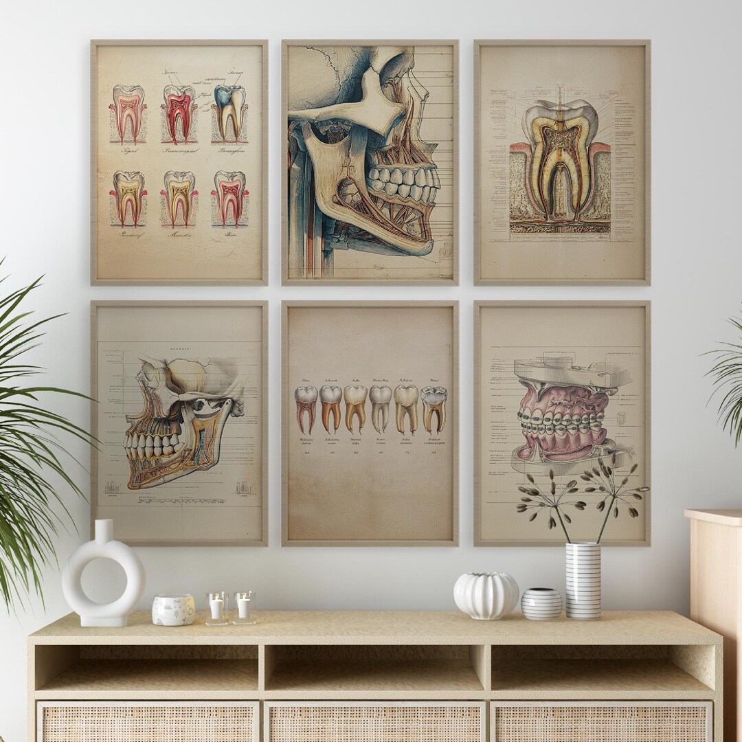 Vintage Dental Anatomy Art Prints • Dentist Office Decor (set of 6 ...