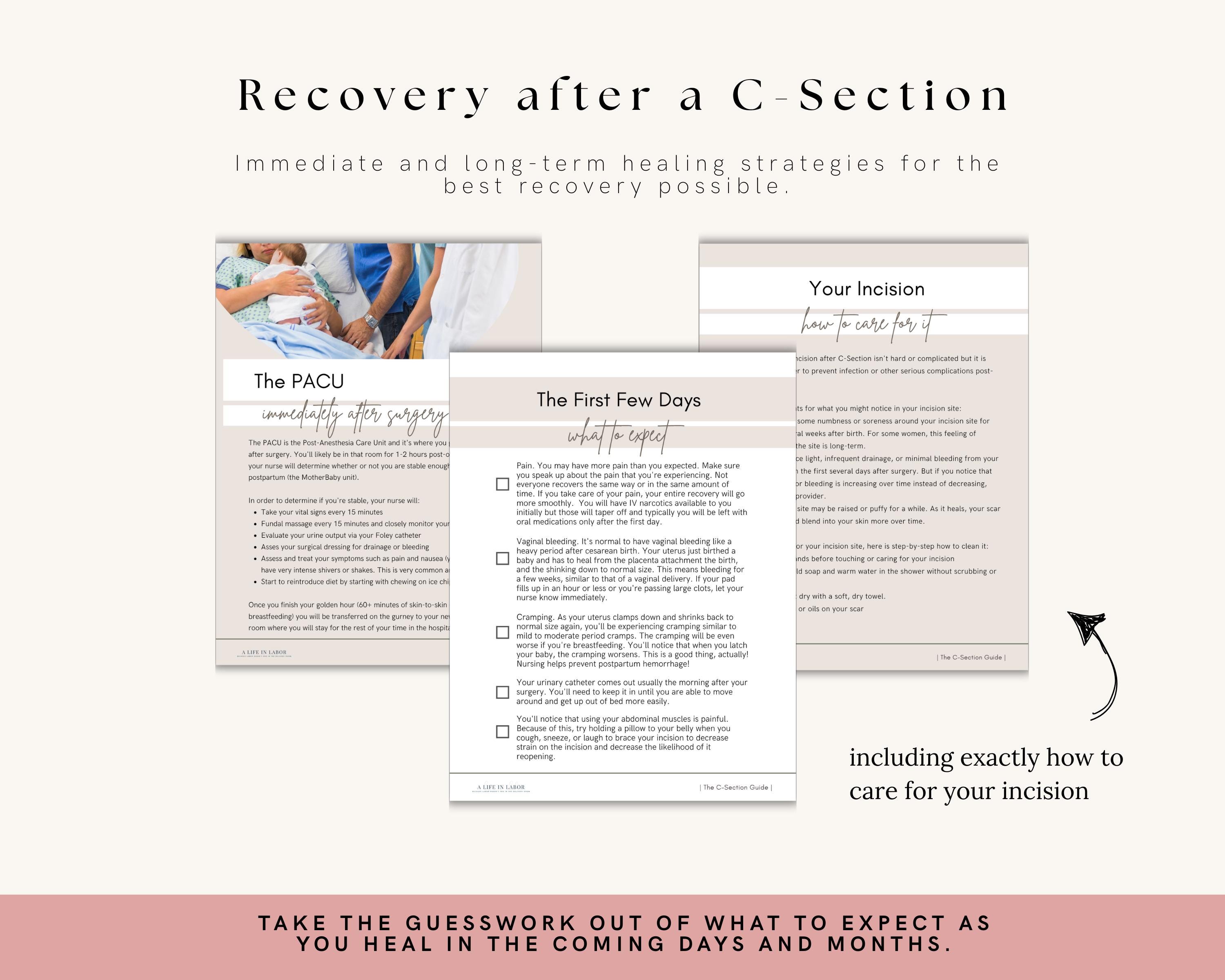 C-section Birth Guide | Empowering Cesarean Recovery & Preparation | In ...