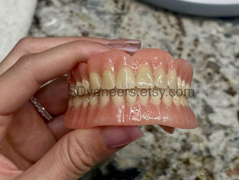 Dentures. Missing Teeth. Dientes Prótesis . Custom Made Denture ...