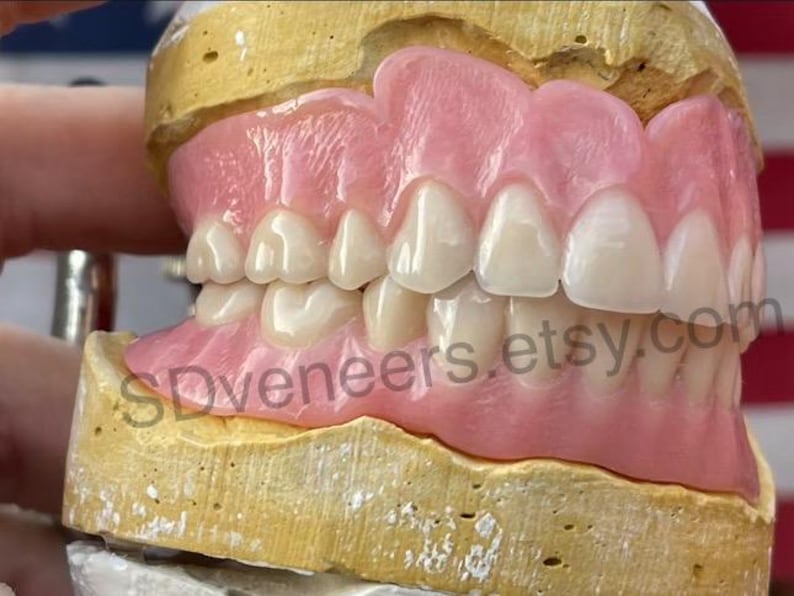 Dentures. Missing Teeth. Dientes Prótesis . Custom Made Denture ...